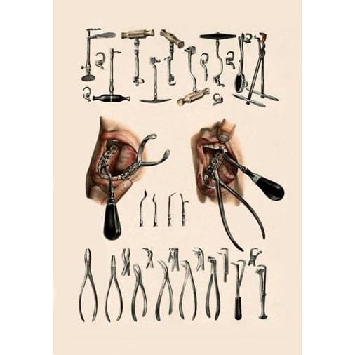 Antique Medical Illustration Of Examples Of Dental Tooth – Vintage ...